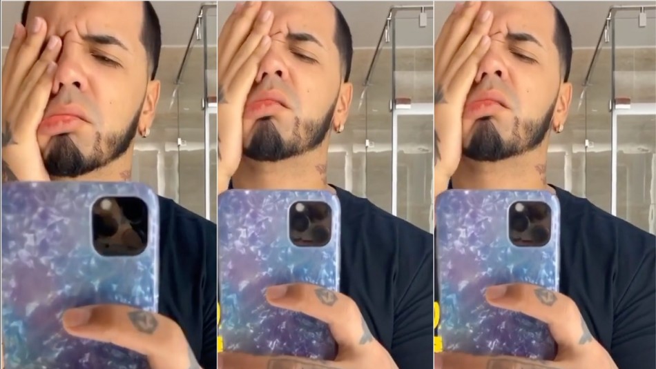 Anuel AA confirma su preocupación por la calvicie en un video que puso ...
