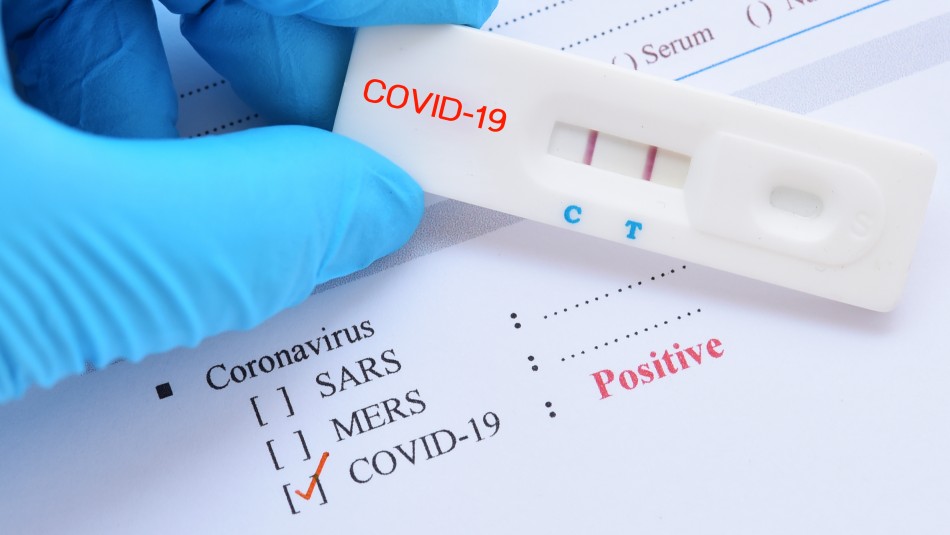 Examen PCR: ¿Cómo funciona el test para detectar el coronavirus ...