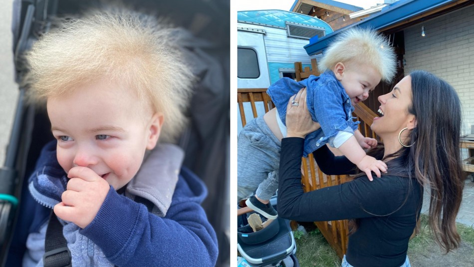 Expertos buscan una cura: Niño sufre de síndrome que hace imposible ...