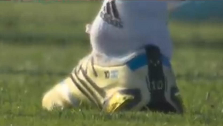 Esta es la explicación detrás de la foto del tobillo de Messi que ...