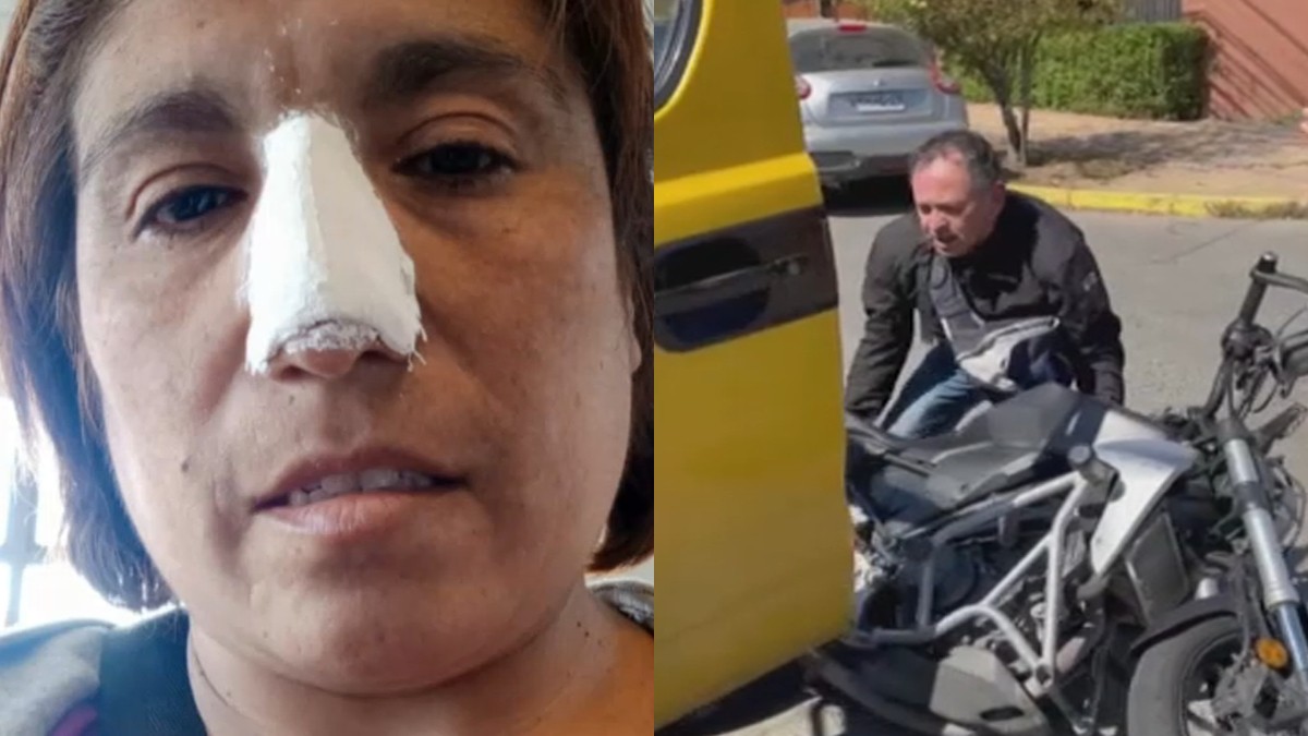 Conductora De Furgón Escolar Agredida Por Motociclista No Era Una