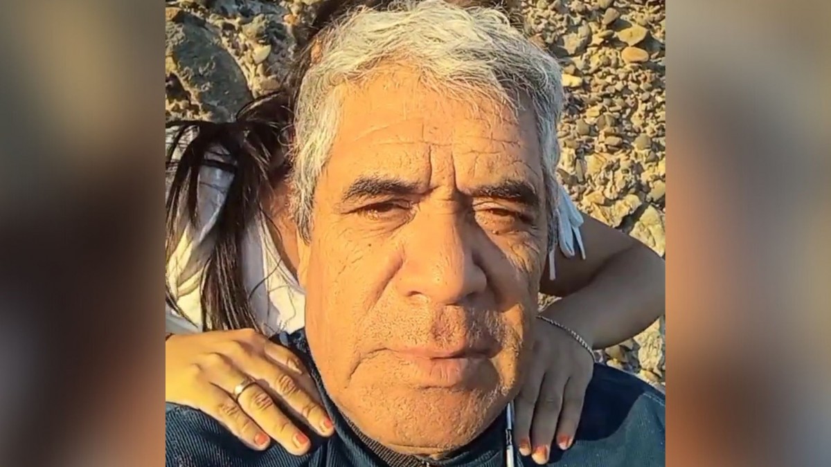 "Entró a pabellón": 'Turrón' de Millenium Show se sometió a cirugía en ...